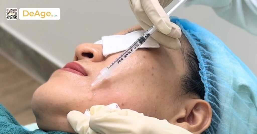 Hướng dẫn chăm sóc da sau tiêm meso giúp da phục hồi nhanh và rạng rỡ ...