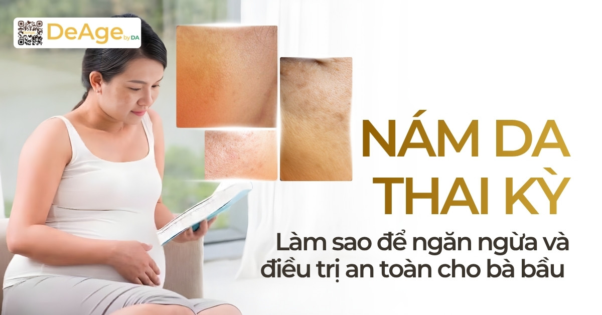 Nám da thai kỳ: làm sao để ngăn ngừa và điều trị an toàn cho bà bầu ...