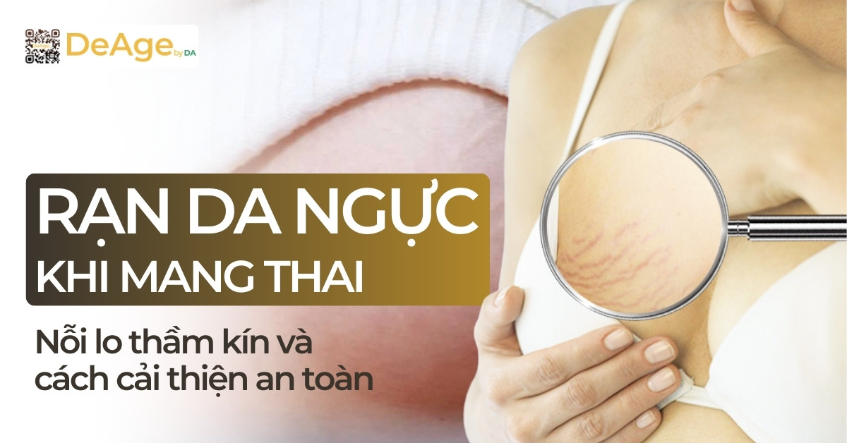 Rạn da ngực khi mang thai - nỗi lo thầm kín và cách cải thiện an toàn ...