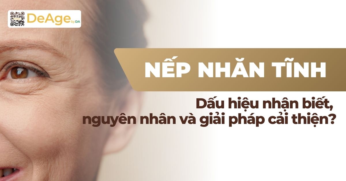 Nếp nhăn tĩnh: dấu hiệu nhận biết, nguyên nhân và giải pháp cải thiện ...
