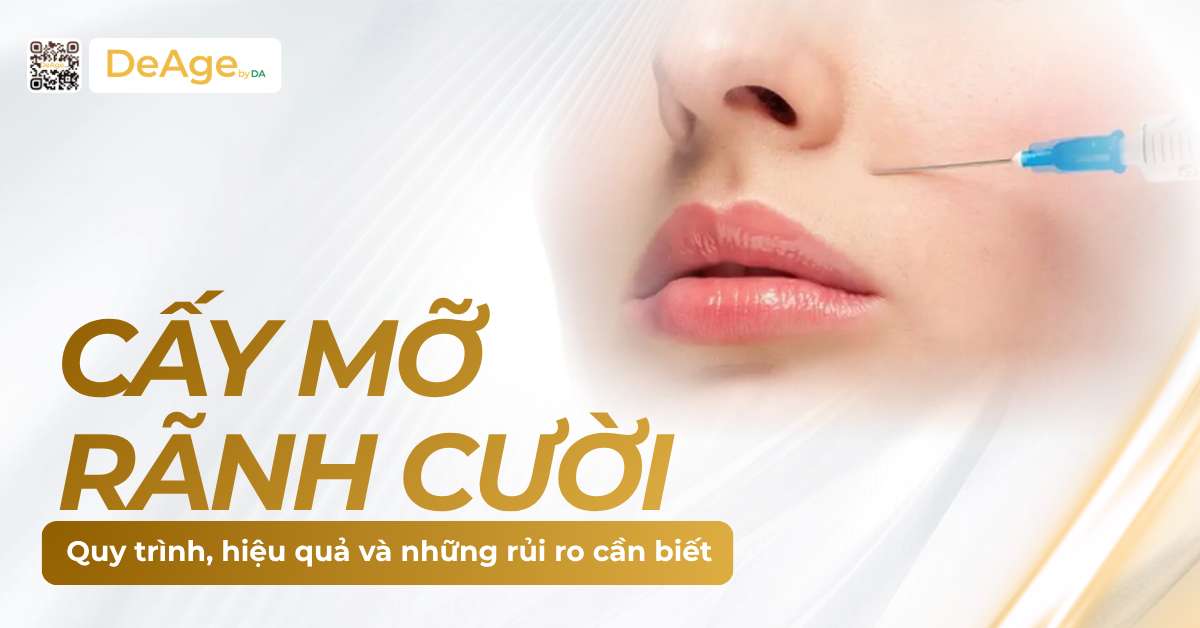 Cấy mỡ rãnh cười: quy trình, hiệu quả và những rủi ro cần biết - DeAge ...